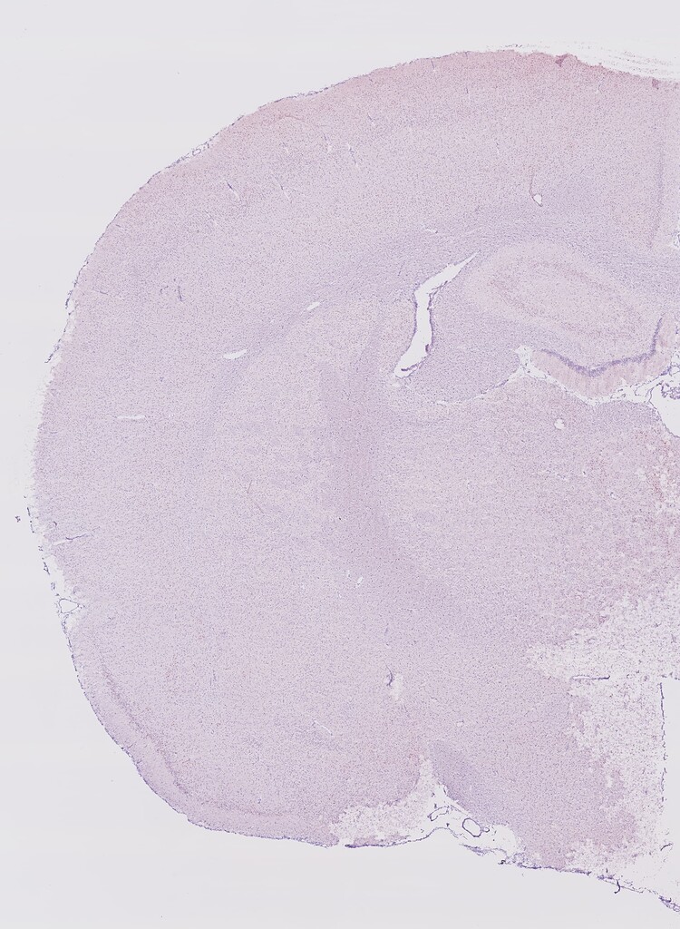 Set the right threshold - Usage & Issues - Image.sc Forum