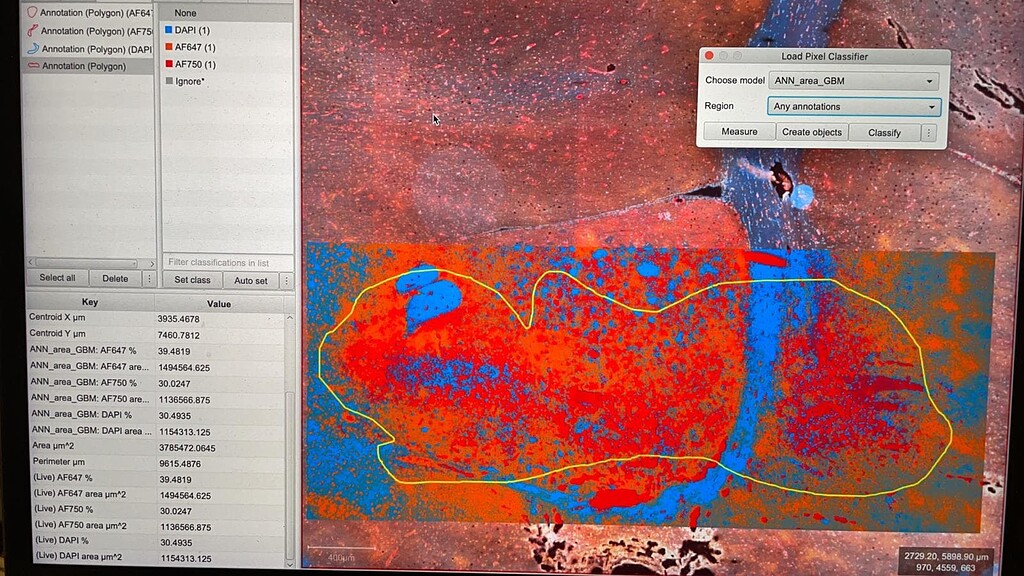 Visualisation of Pixel Classifier - Usage & Issues - Image.sc Forum
