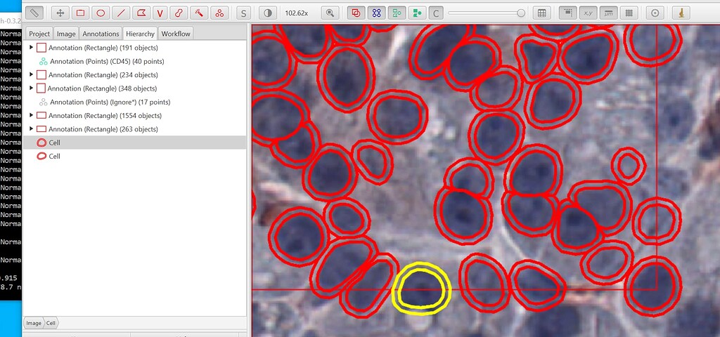 Stardist Hierarchy Bug - Usage & Issues - Image.sc Forum