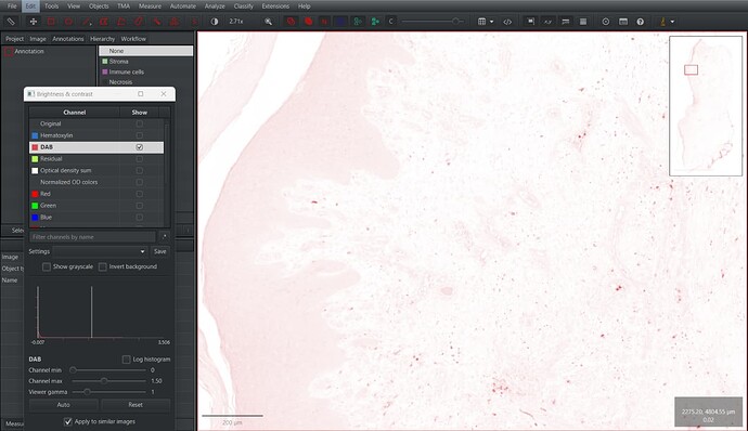 ᴗ•)/ QuPath scripting (#6): Customized 3 stain color deconvolution - Usage & Issues - Image.sc Forum