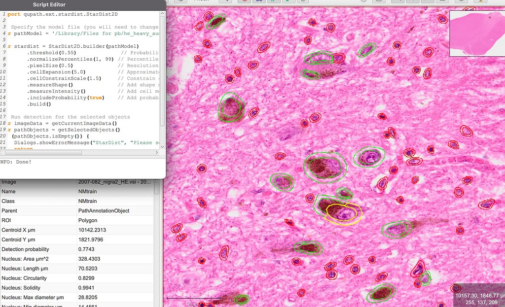 Issues with multiple cell detections (using stardist) - Image Analysis - Image.sc Forum