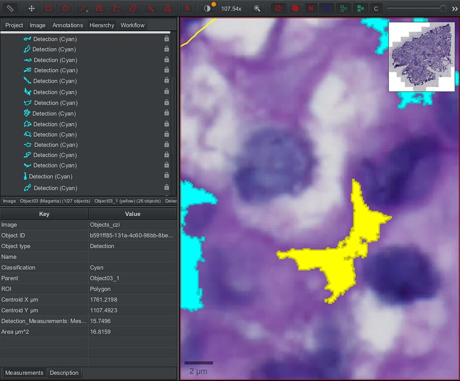 Exporting annotations and detections in QuPath as .geojson or .json - Usage & Issues - Image.sc ...