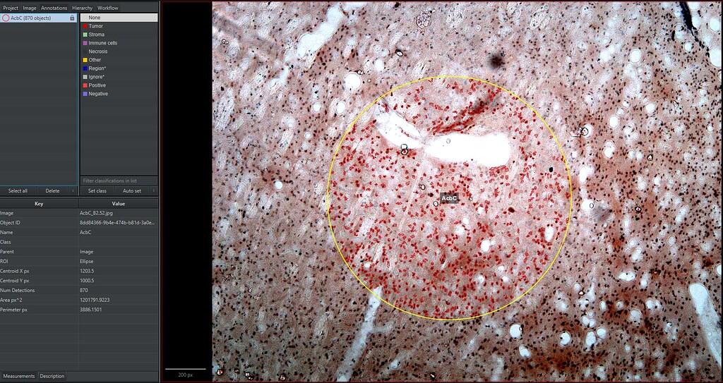How can I identify the size of the annotation area in mm²? Qupath - Image Analysis - Image.sc Forum