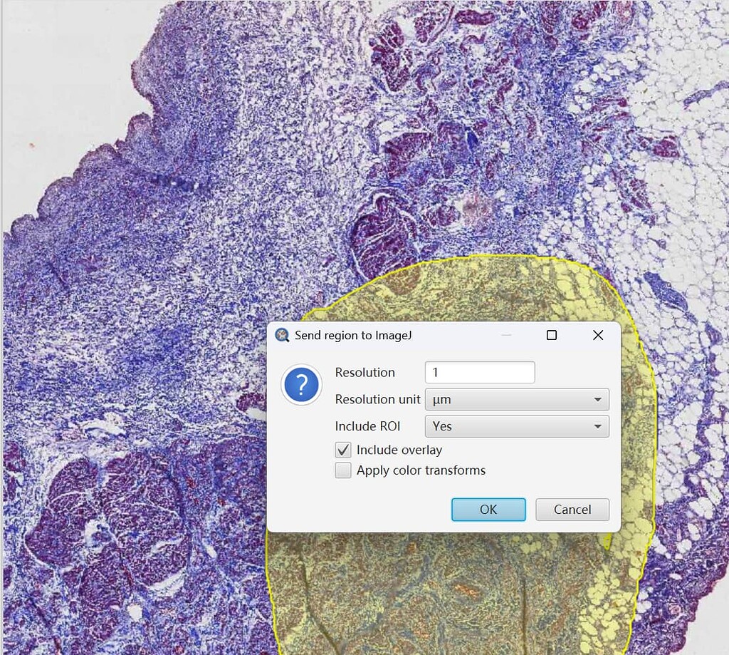 How can I send the precise ROI region from Qupath to ImageJ? Currently, I can only send regions ...
