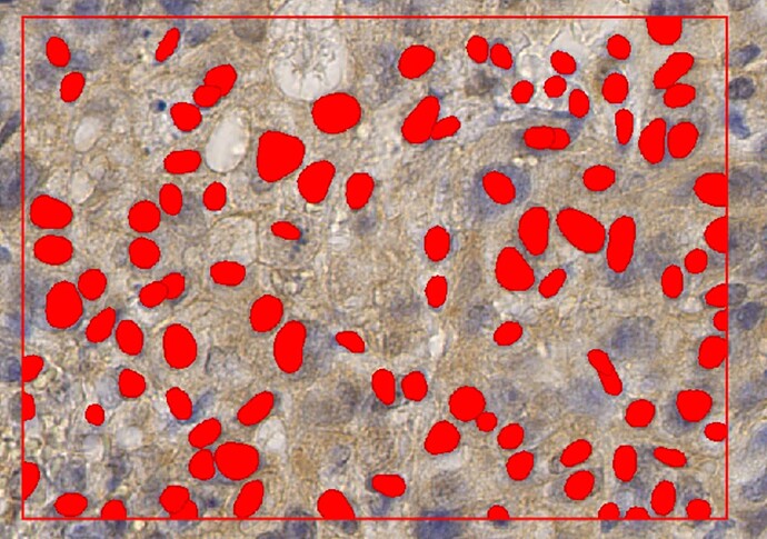Creating my own segmentation model using cellpose - Image Analysis ...