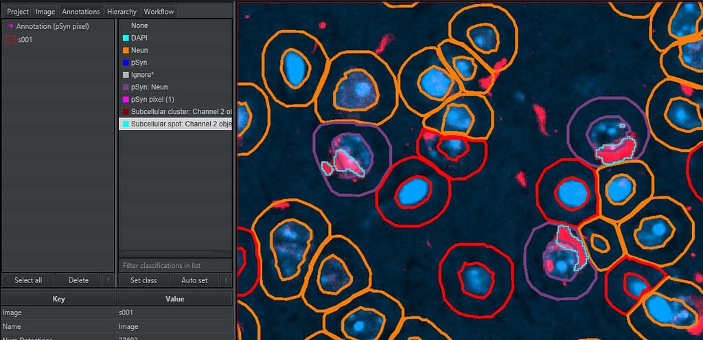 Segementation for Subcellular Objects QUINT - Image Analysis - Image.sc Forum