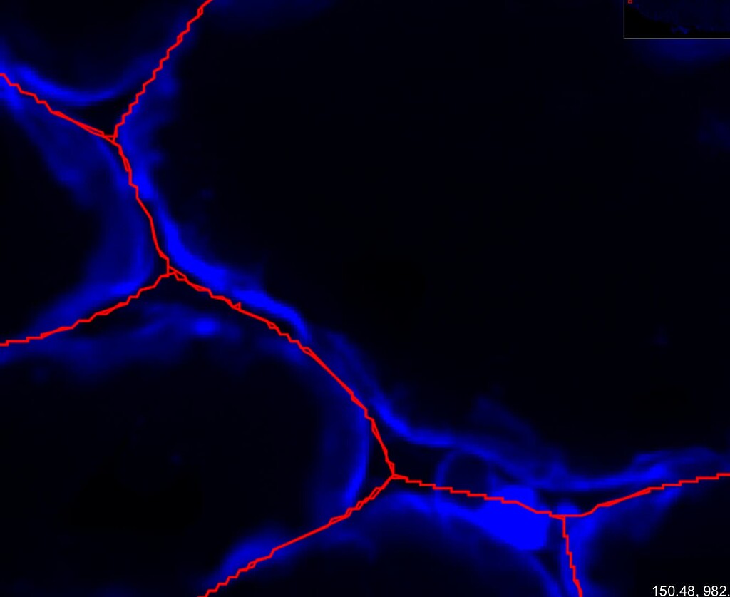 Qupath muscle cell segmentation - annotation thickness - Image Analysis - Image.sc Forum