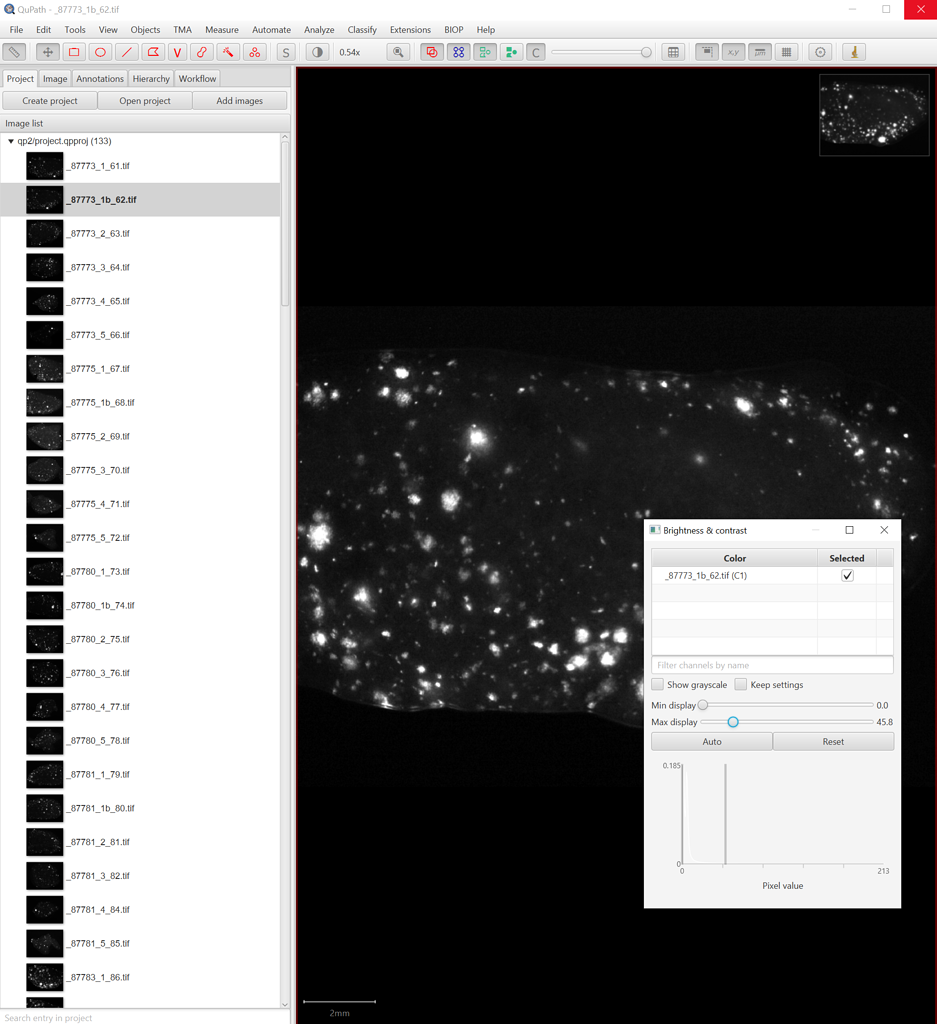 QuPath - 1 channel image - channel name = image name - Usage & Issues - Image.sc Forum