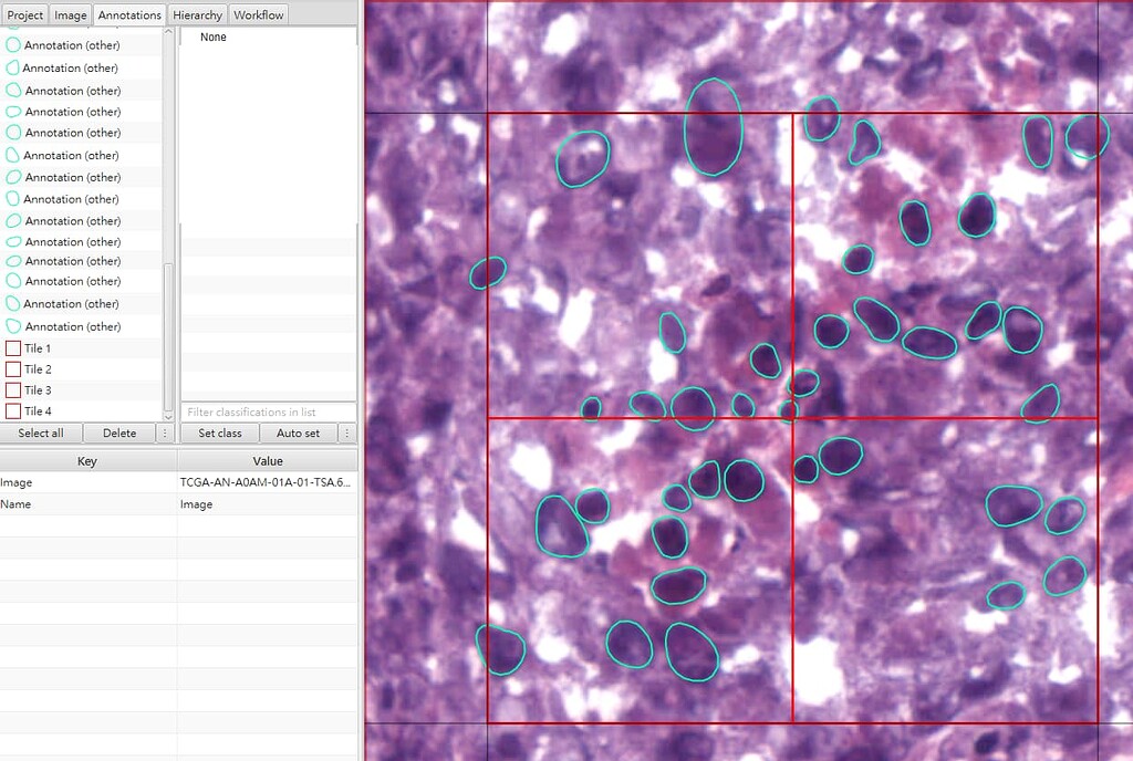 Export the annotations GeoJSON file without parent objects and tile annotations - Usage & Issues ...