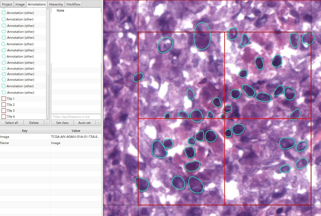 Export the annotations GeoJSON file without parent objects and tile annotations - Usage & Issues ...