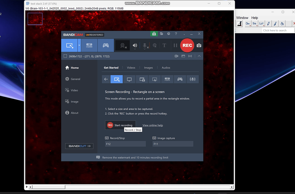 Making slices into Z-stacks in ImageJ FIJI - Image Analysis - Image.sc ...
