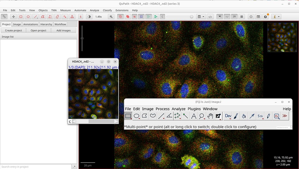 Embedding Fiji inside QuPath - Development - Image.sc Forum