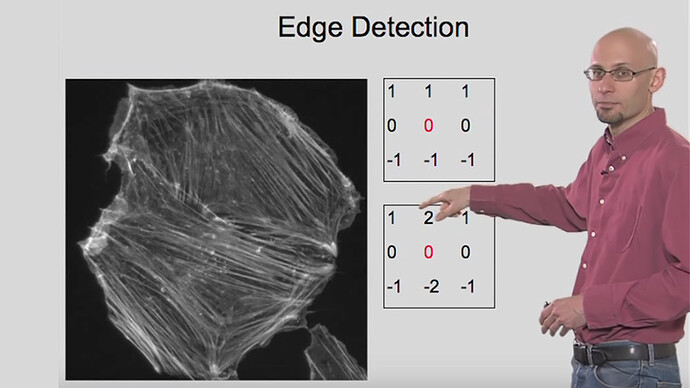 Help with creating and using masks in ImageJ - Image Analysis - Image ...