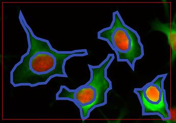 Combining Cellpose and StarDist detections into cells - Image Analysis - Image.sc Forum