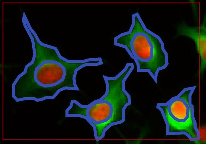 Combining Cellpose and StarDist detections into cells - Image Analysis - Image.sc Forum