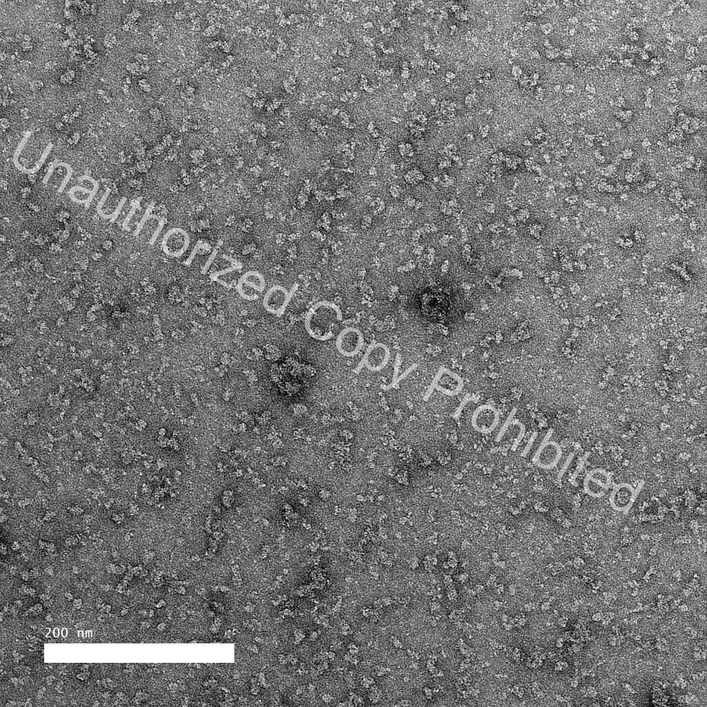 How to auto-selection protein site in TEM image by analysis software ...