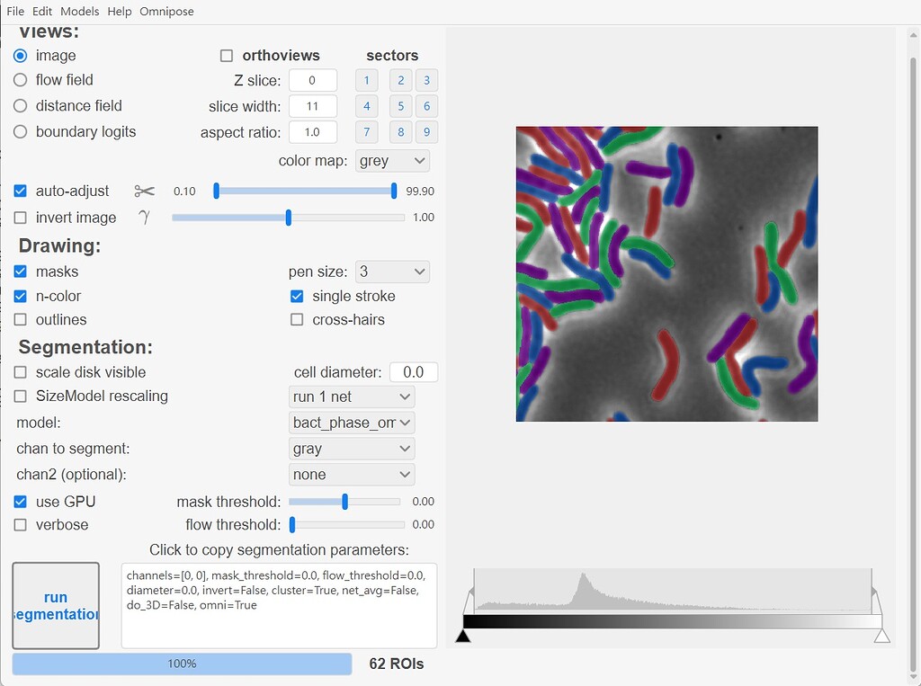 Omnipose with less masks than segmented cells - Usage & Issues - Image.sc Forum