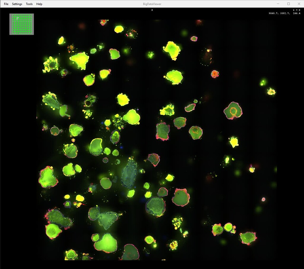 Bigstitcher global optimization problem - Usage & Issues - Image.sc Forum