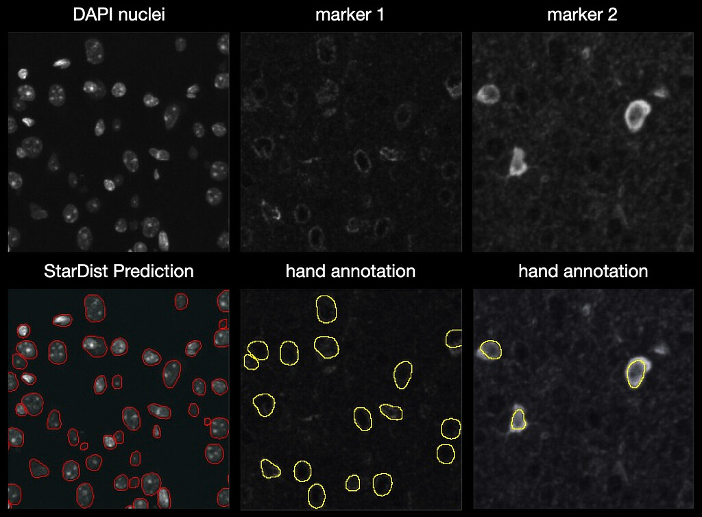 Using Stardist As A Start For Further Classification Image Analysis Image Sc Forum
