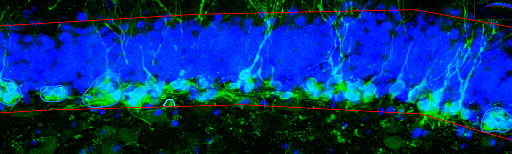 Make stardist detect cells based on colour and given area range - Image Analysis - Image.sc Forum