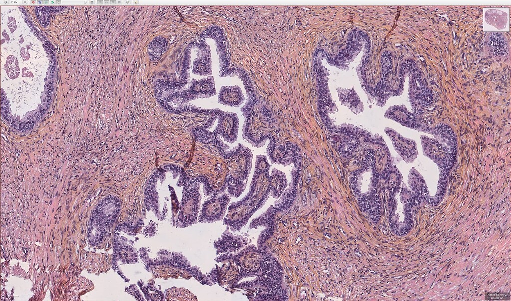 Problem with ndpi files - Usage & Issues - Image.sc Forum