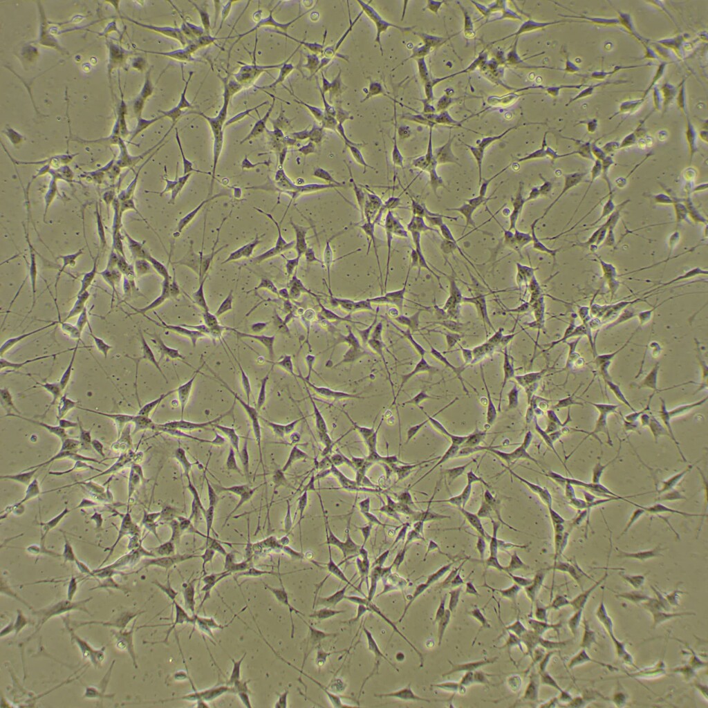 Would it be possible to analyze the neurite outgrowth from bright field ...