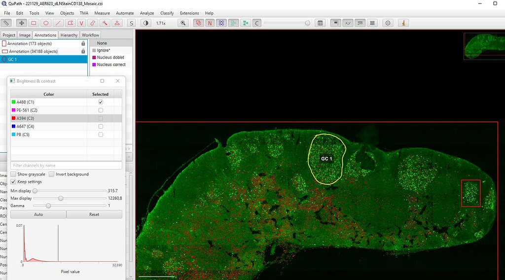 Qupath annotation load after detections on the whole tissue to count number of detections in ...