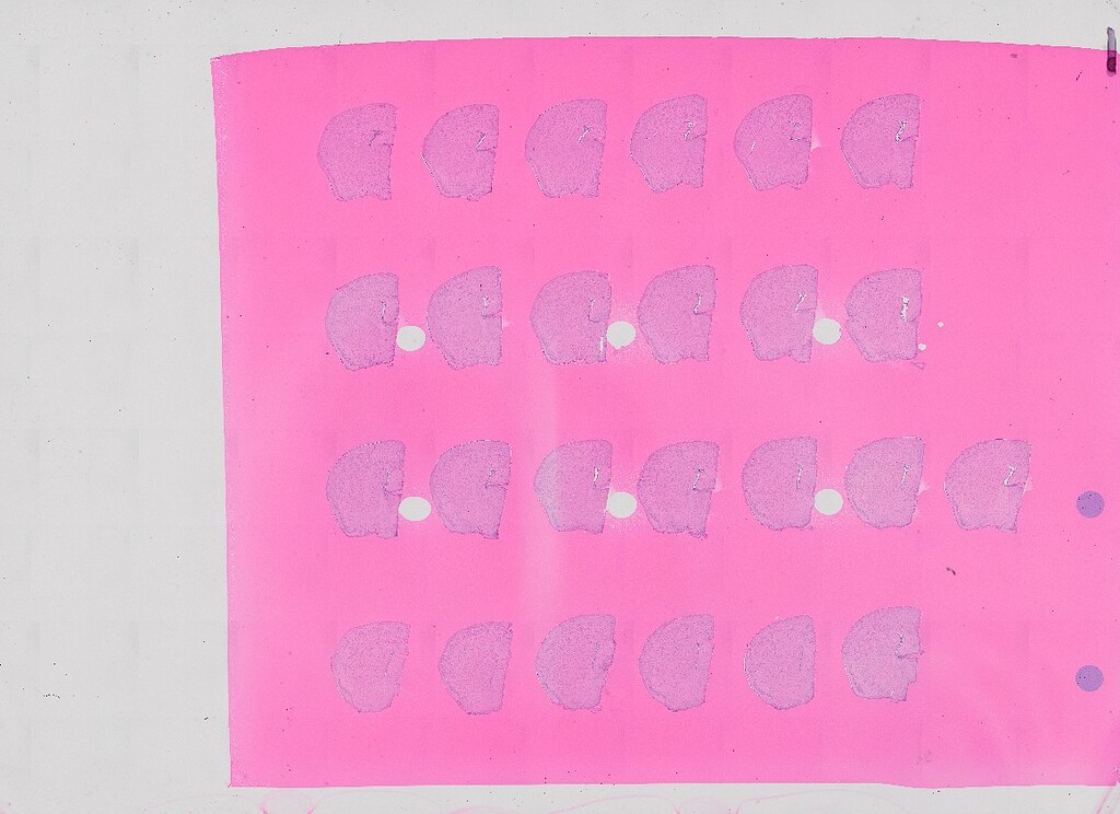 ImageJ Cell Counting Automation: HE Stain, Nuclei - Image Analysis - Image.sc Forum