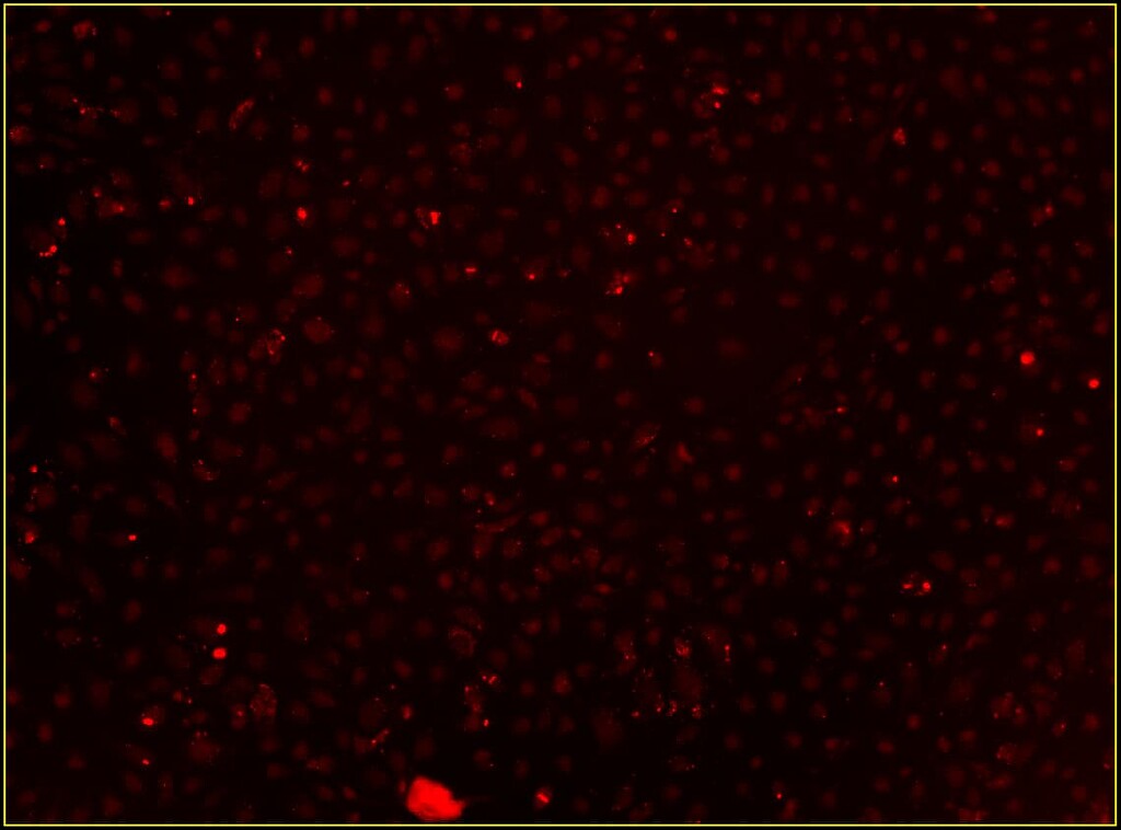 Qupath Cell Detection | Ignore / Exclude maximum threshold. | Ignore bright stained - Image ...