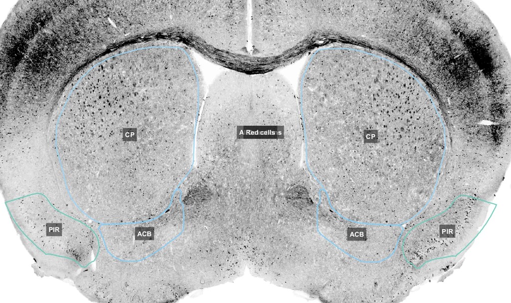 Help for using the BraiAn plugin to detect manually modified ABBA annotations - Usage & Issues ...