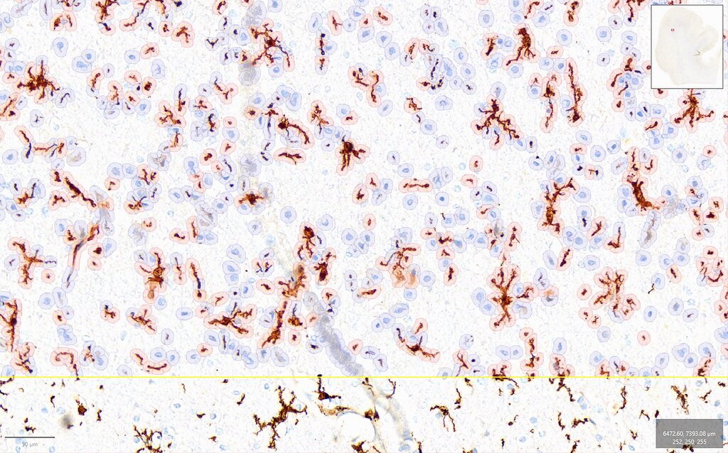 Calculating IHC signal intensity in human microglial cells - Image ...