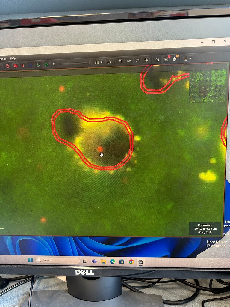 Unable to detect very small intracellular inclusions via subcellular detection method - Image ...