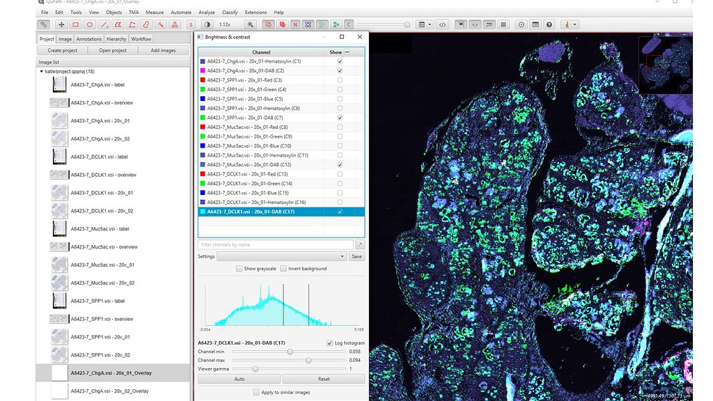 Using vsi for multiplex - how to get single channels in qupath - Image Analysis - Image.sc Forum
