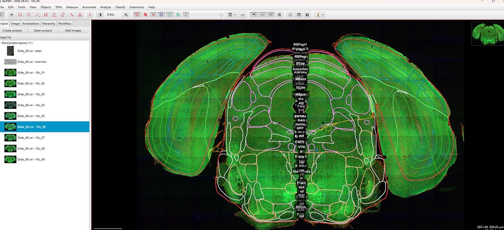 ABBA Alignment Brain Mapping. All brain map annotations are centered - Usage & Issues - Image.sc ...