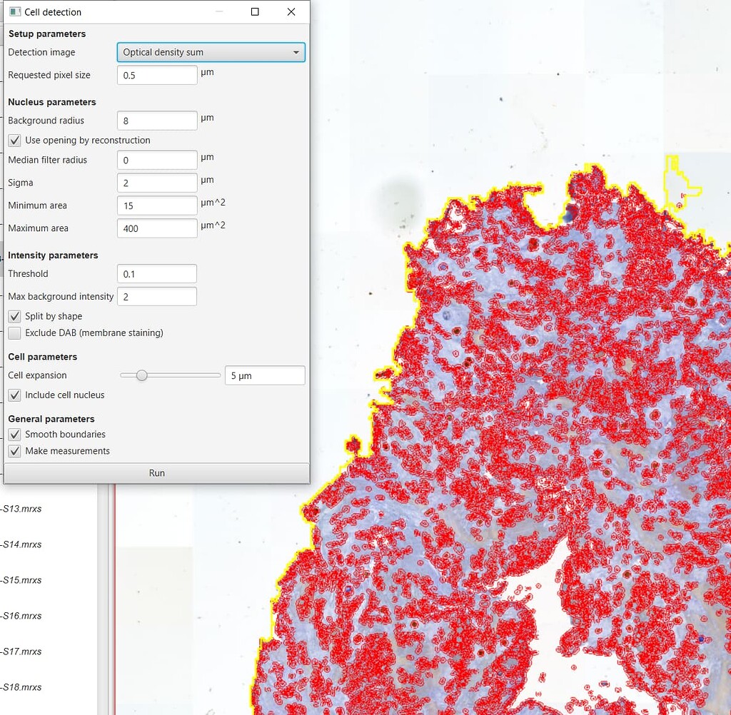 QuPath project running detecting tissue, classifying cells - Image Analysis - Image.sc Forum