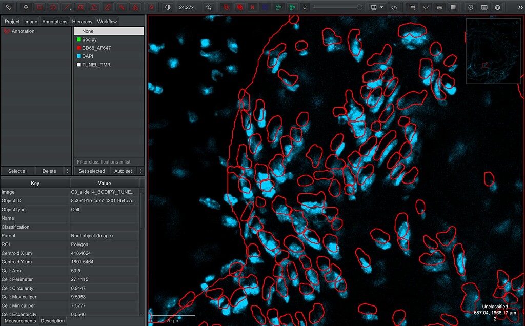 Bug (?) in overlaying nuclei in qupath - Image Analysis - Image.sc Forum