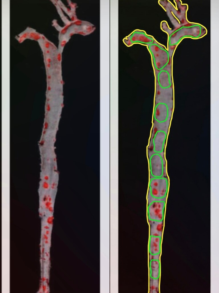Toward LLM based image segmentation? - Image Analysis - Image.sc Forum
