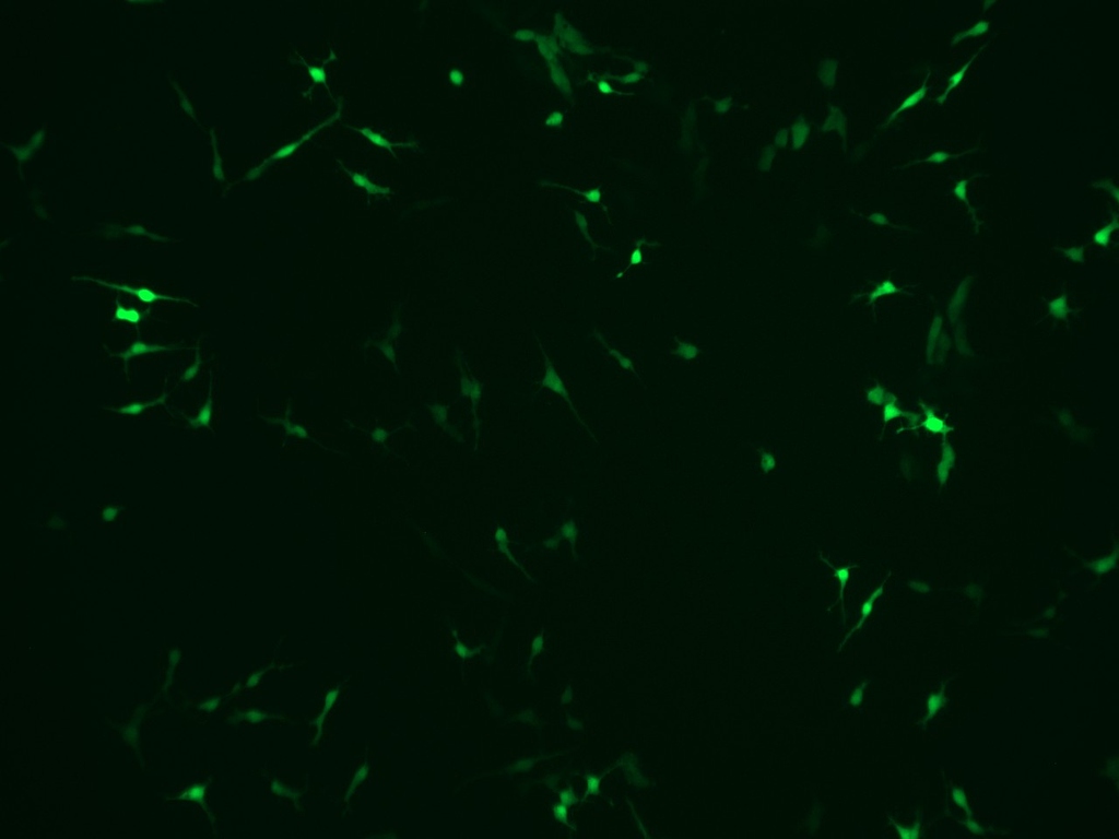 CellProfiler segmentation of DAPI and GFP - Image Analysis - Image.sc Forum