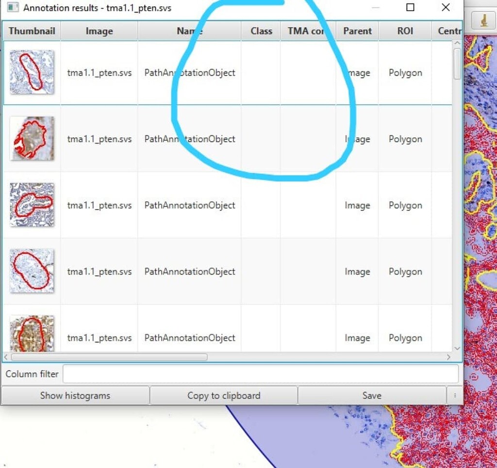 TMA core showing annotations belonging - Image Analysis - Image.sc Forum