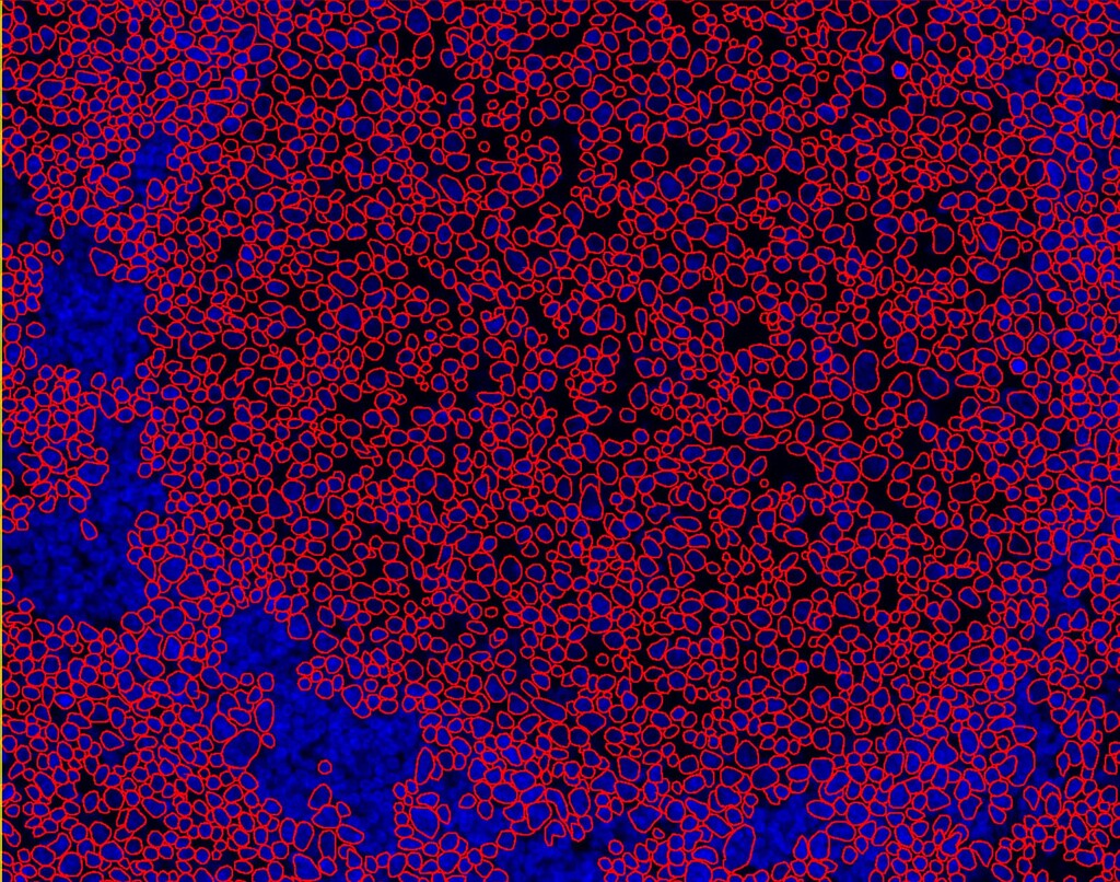 Improving nuclei segmentation in Stardist : DAPI channel - Image Analysis - Image.sc Forum