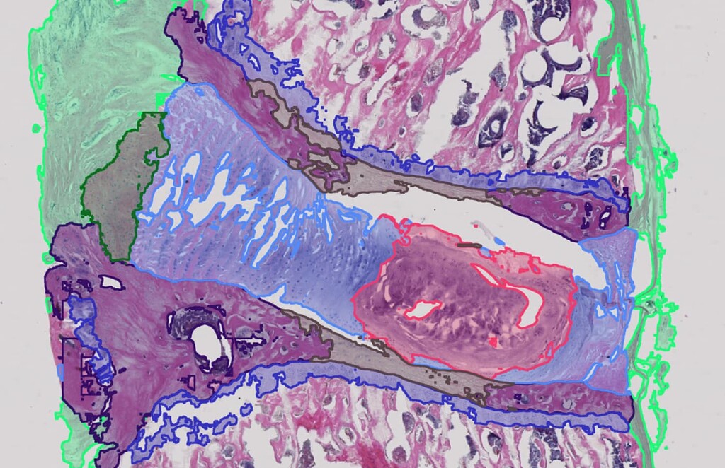 Fill Annotations with Solid Colors - Viewer only - Usage & Issues - Image.sc Forum