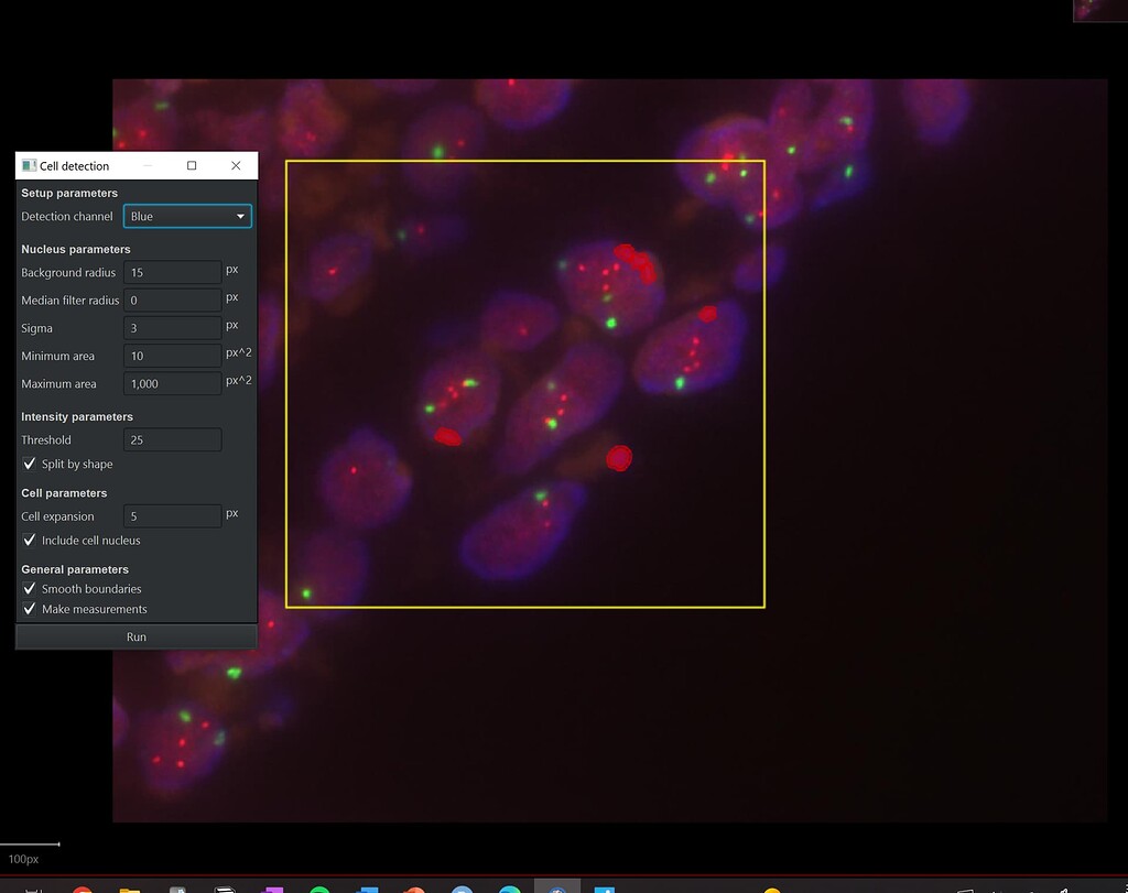 FISH Cell Detection & Subcellular Detection - Image Analysis - Image.sc Forum