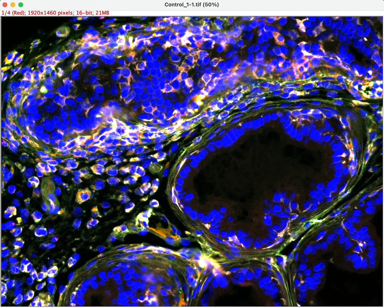 Cell Detection Parameters - What are each of the settings and ...