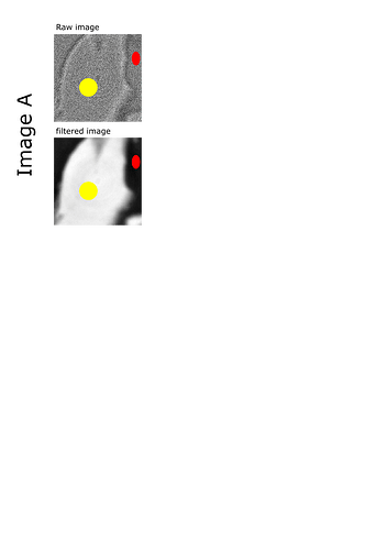 Pixel segmentation in Ilastik using multiple views of the same image - Image Analysis - Image.sc ...