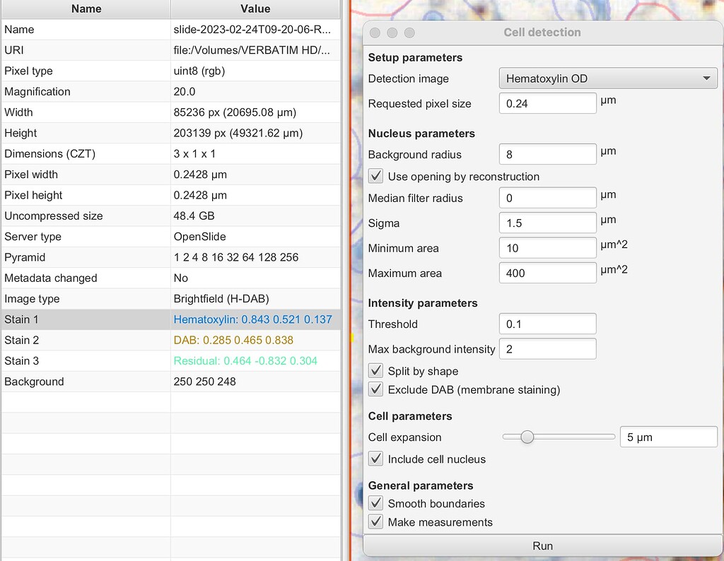 Stardist vs Qupath cell detection, oversegmentation and inadequate seperation of cells - Image ...