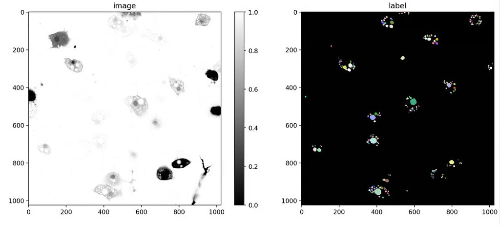 Help with Stardist - Usage & Issues - Image.sc Forum