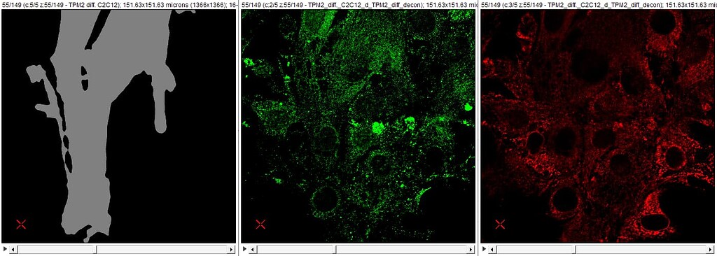 In search of a solution for 3D Intensities’ overlap-based quantifiers with external mask - Image ...