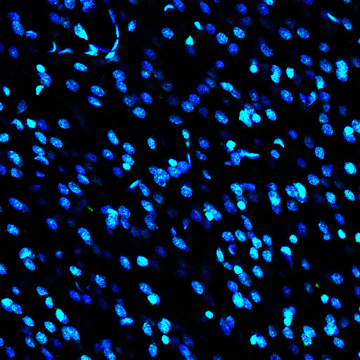 Counting Fluorescent Cells with the Highest Intensity - Image Analysis ...
