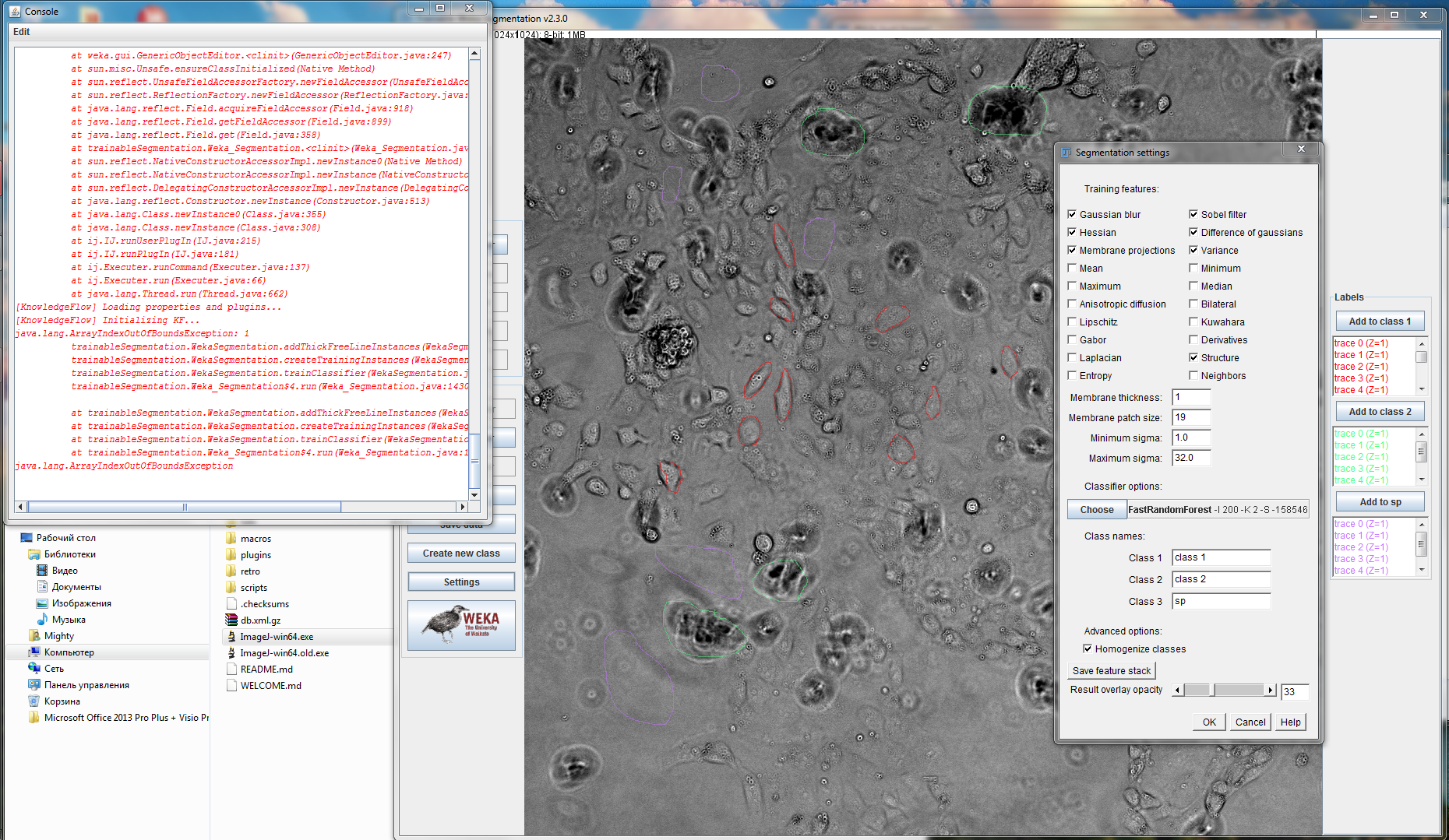 Cell segmentation on bad images using weka (manual) - Image Analysis ...
