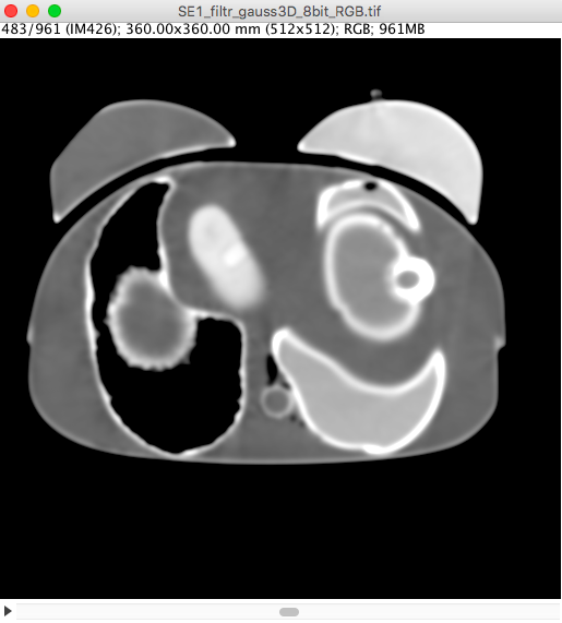Creating a mask. CT scans - Image Analysis - Image.sc Forum